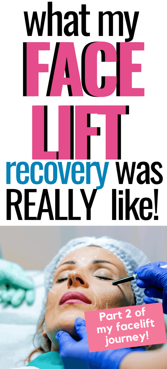 Erin’s Facelift Experience Part 2: What Recovery is Really Like - I Spy ...